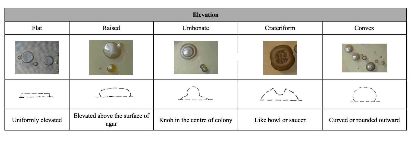 Bacterial Colony Morphology - BiokiMicroki